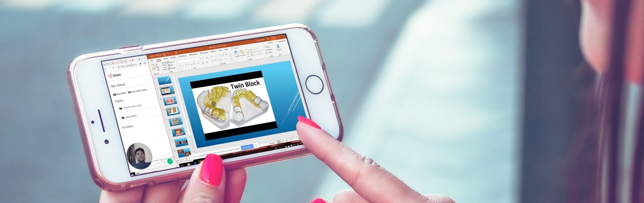 The MARA appliance is the alternative to block braces - [VIDEO]