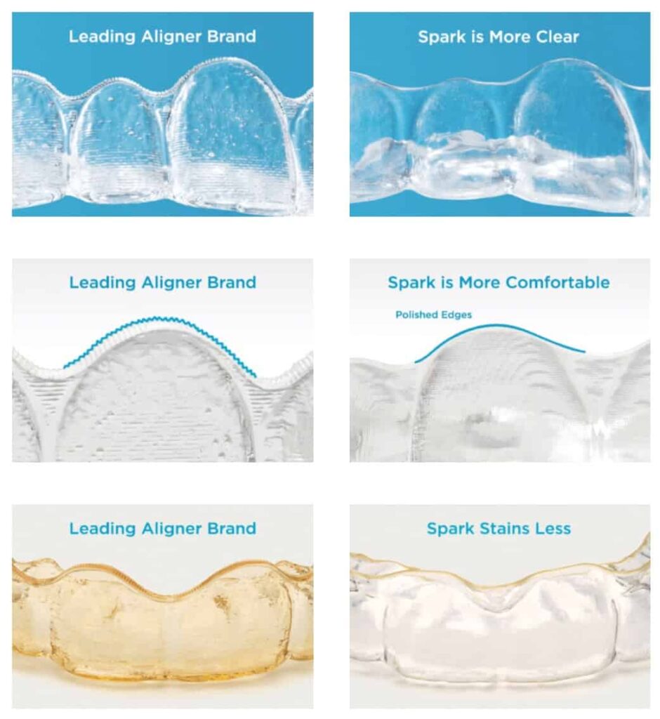 Spark Aligners Derby - Treat a variety of teeth-straightening cases ...